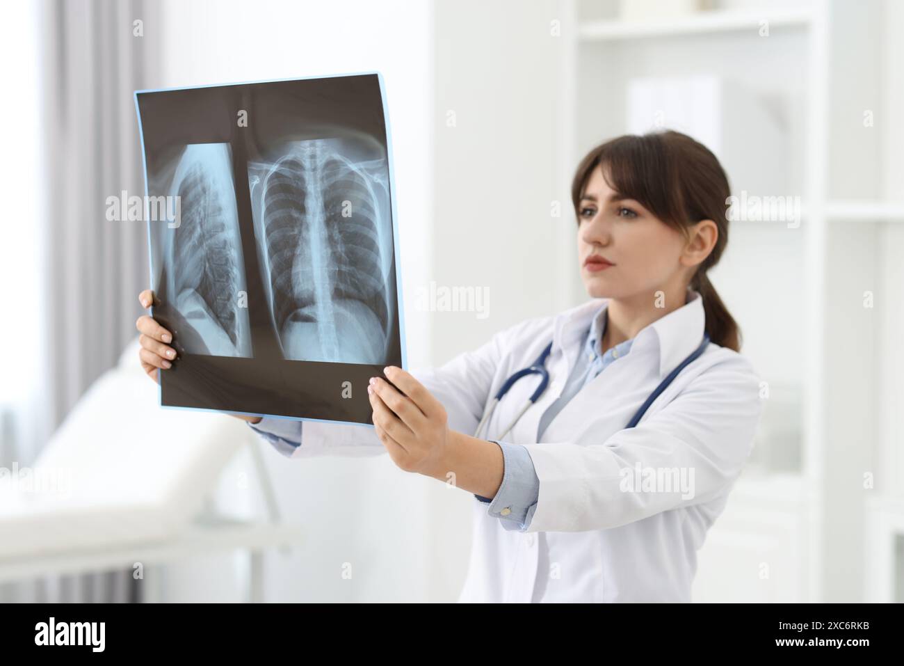 Lung disease. Doctor examining chest x-ray in clinic Stock Photo - Alamy