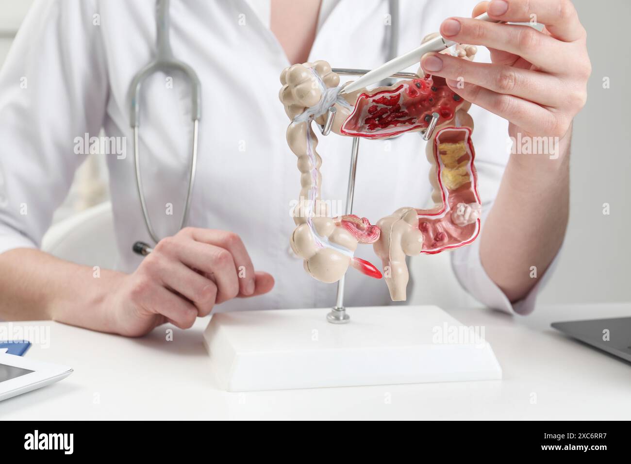 Doctor showing model of large intestine at white table in clinic ...