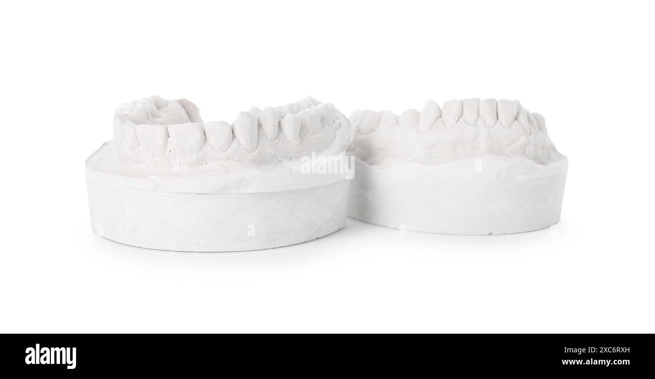 Dental model with jaws isolated on white. Cast of teeth Stock Photo - Alamy