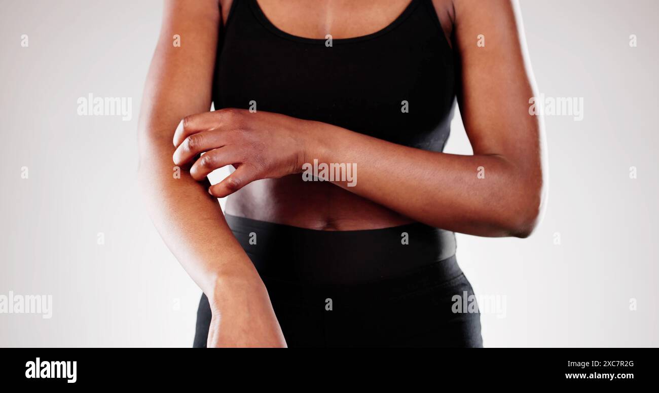 The Dermatologist Treating An African American Woman With Dry, Itchy ...