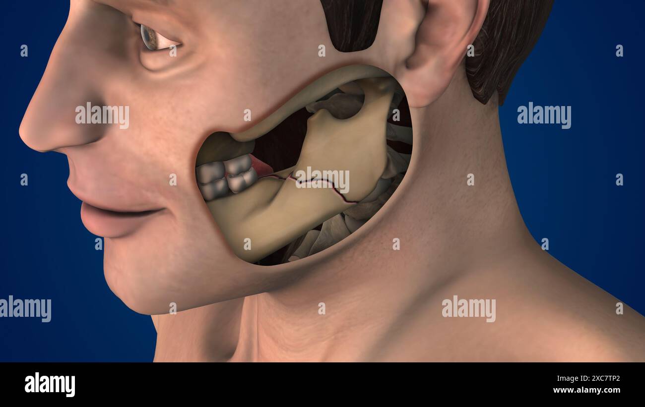 Anatomy skull fracture hi-res stock photography and images - Alamy