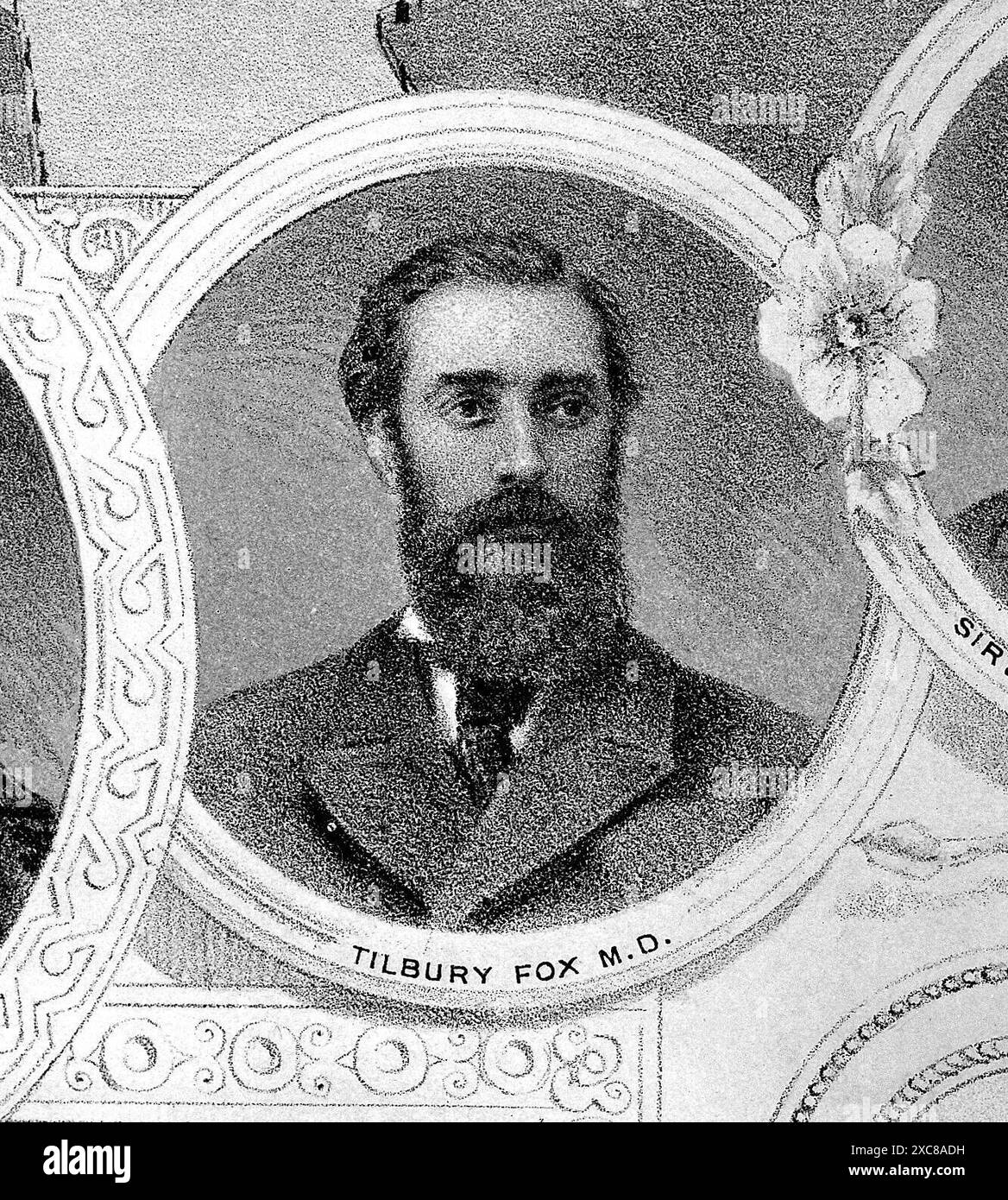 This black and white portrait depicts William Tilbury Fox MD (1836-1879 ...