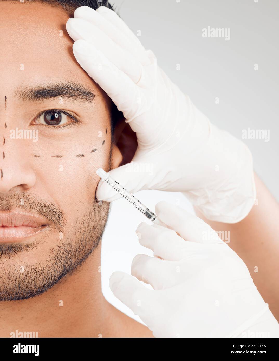 Man face surgery marks hi-res stock photography and images - Alamy