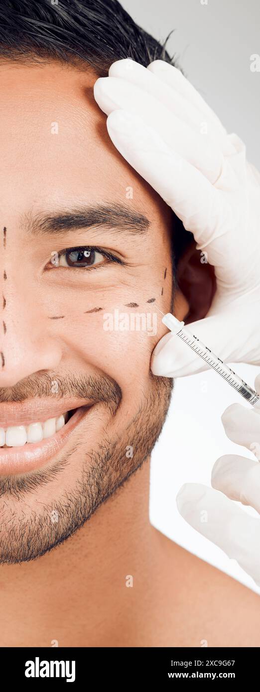 Man face surgery marks hi-res stock photography and images - Alamy