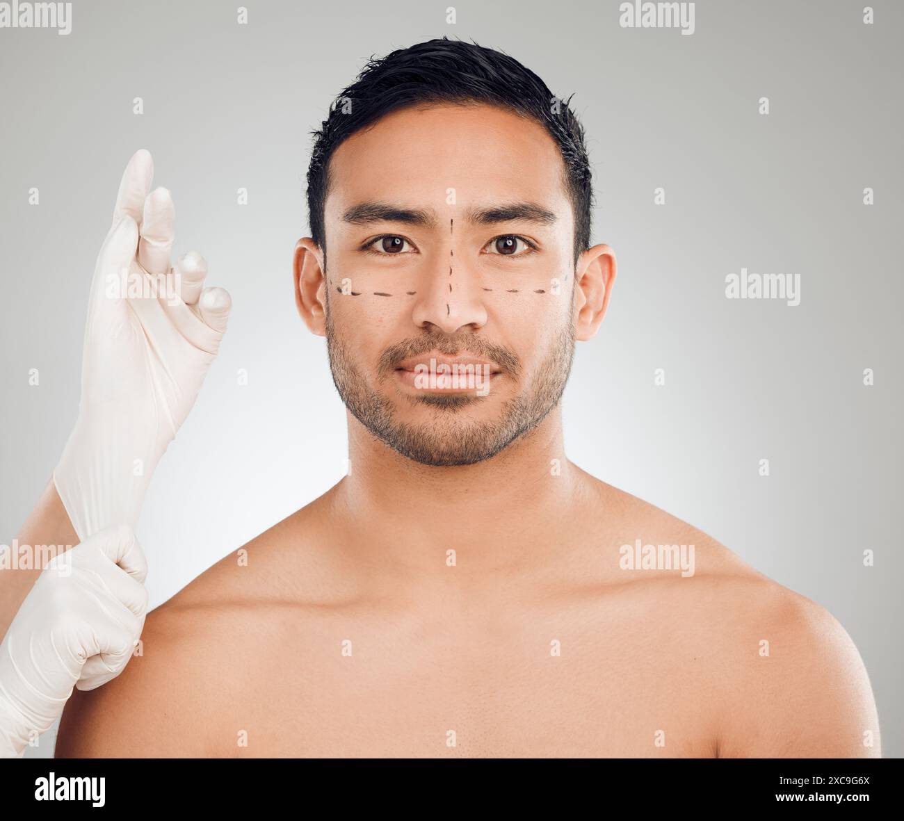 Man face surgery marks hi-res stock photography and images - Alamy
