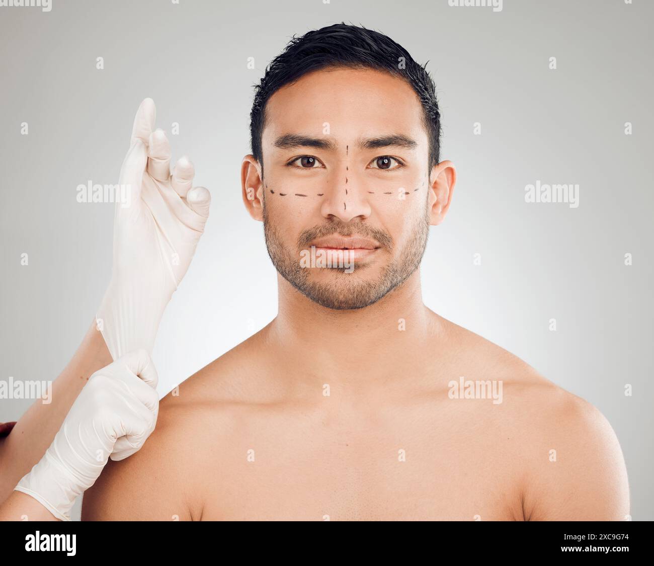 Man face surgery marks hi-res stock photography and images - Alamy