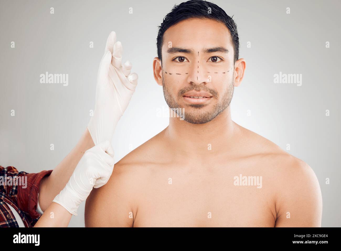 Plastic surgery, hands and drawing marks on face for man, rhinoplasty ...