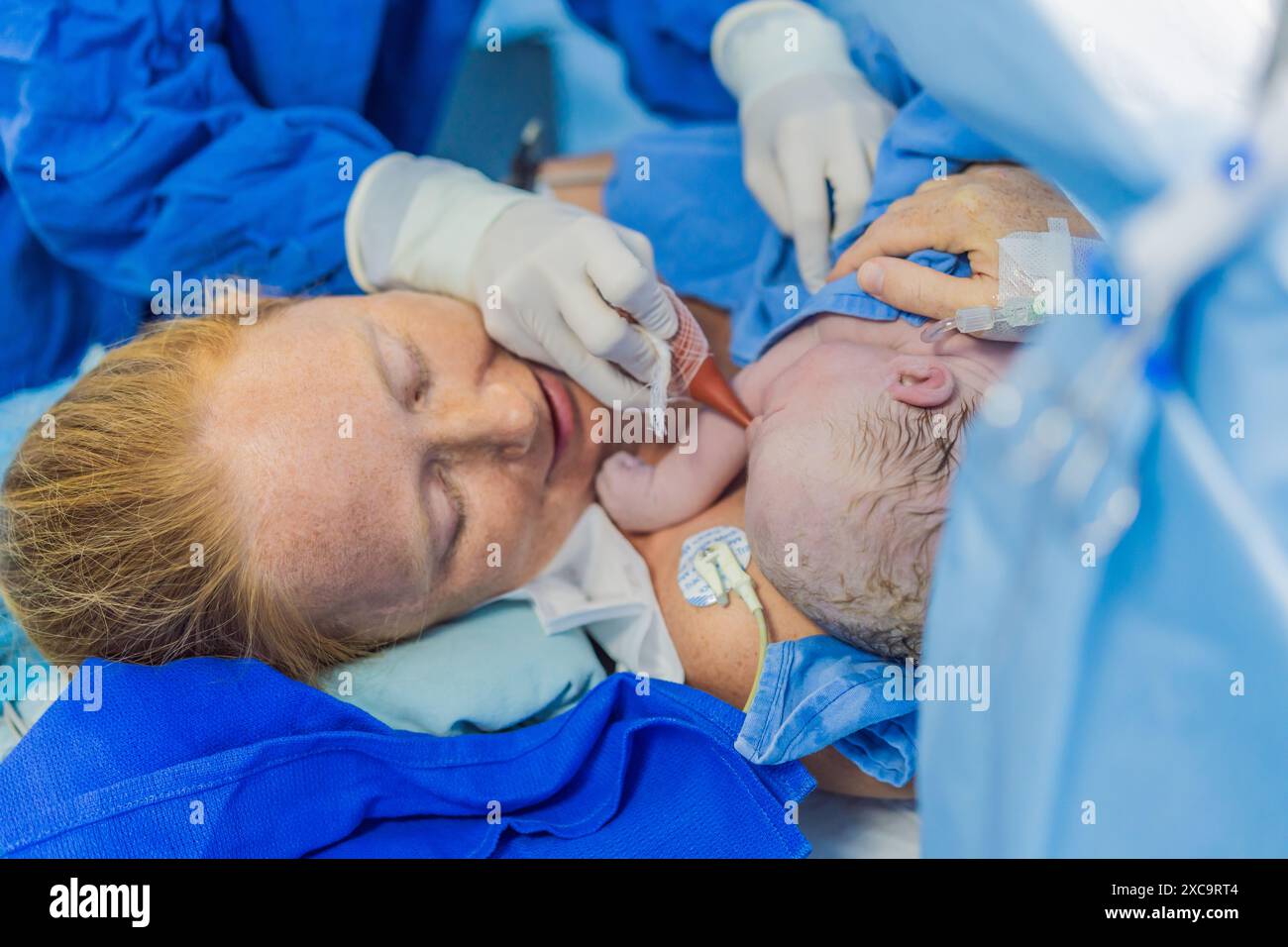 Baby on mother's chest immediately after birth in a hospital. The ...