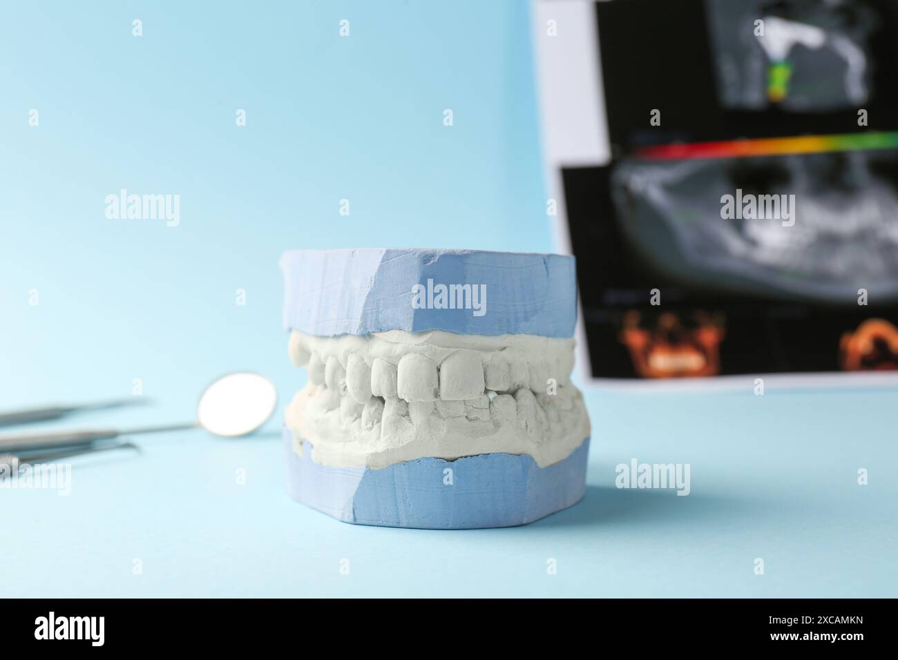 Dental model with gums, panoramic x-ray and dentist tools on light blue ...