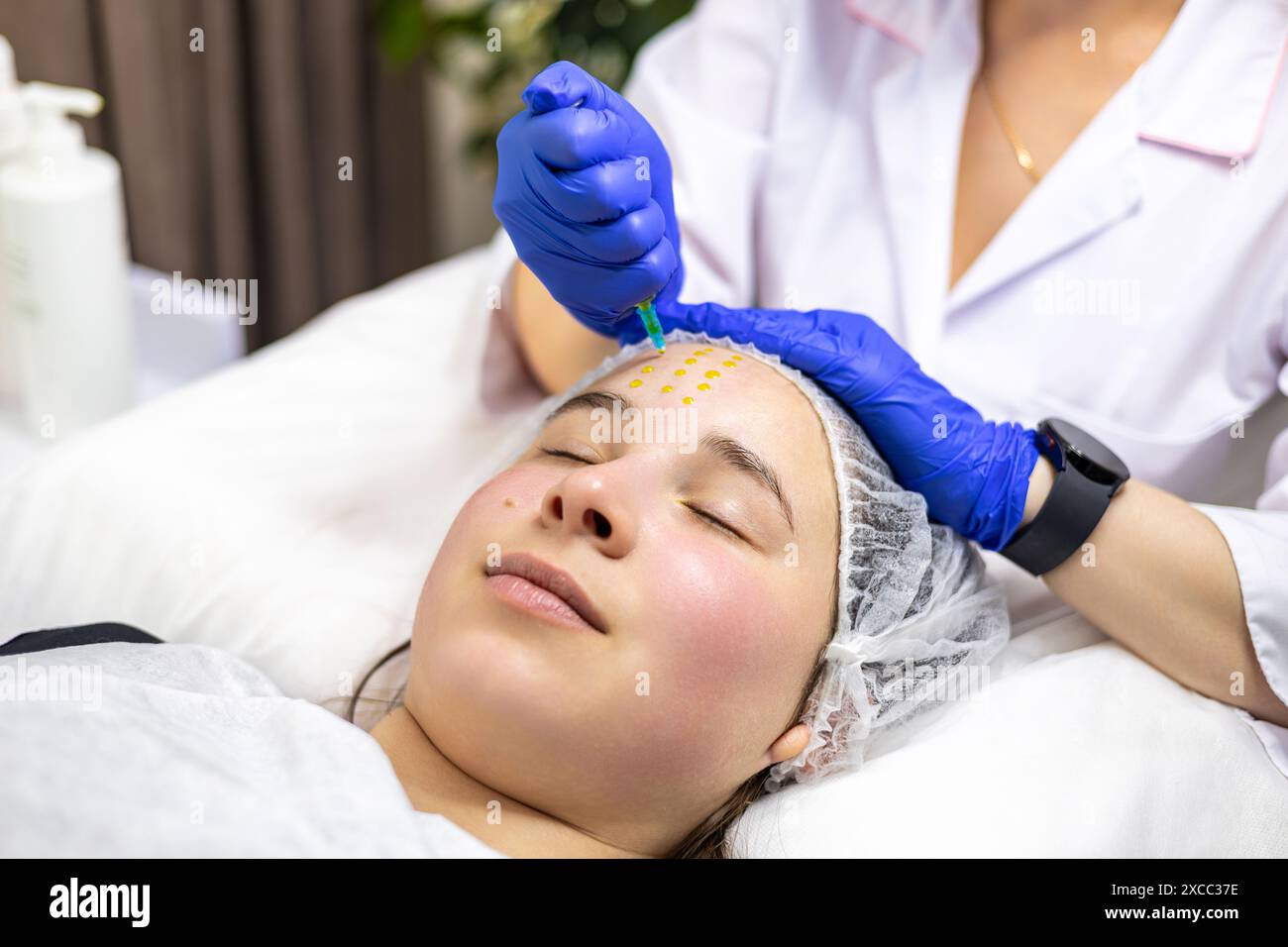 Process of a beauty procedure, the dermatologist is applying a yellow ...