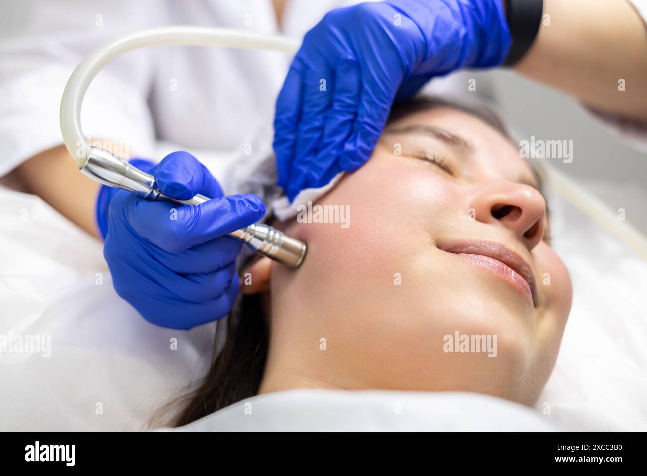 A professional dermatologist wearing medical gloves performs a ...
