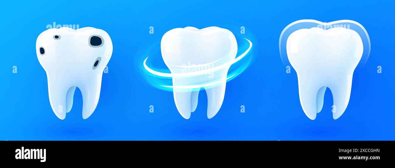 3d realistic vector healthy glowing tooth. Caries healing and ...