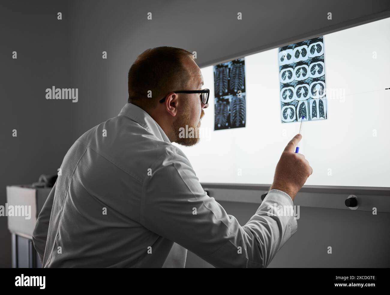 Computed tomography chest ct scan hi-res stock photography and images ...