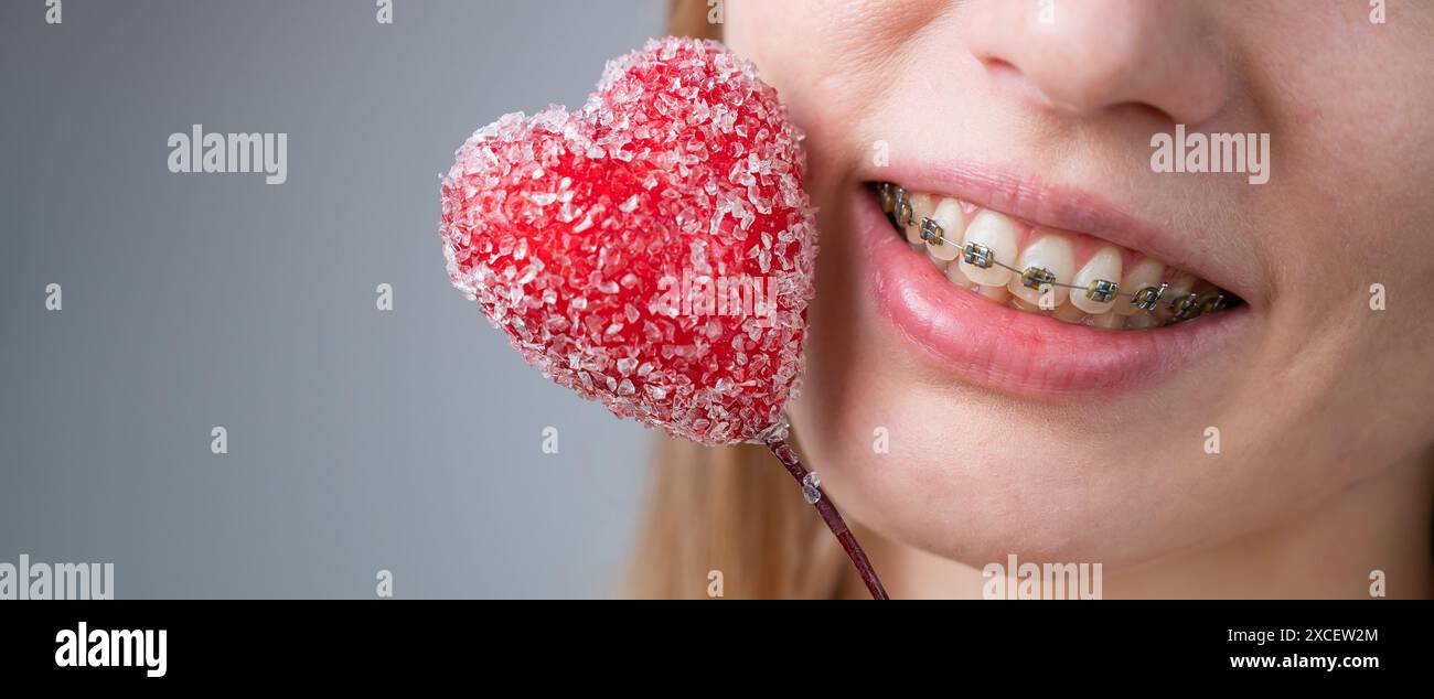 Cute woman with braces on her teeth holds a candy in the form of a ...