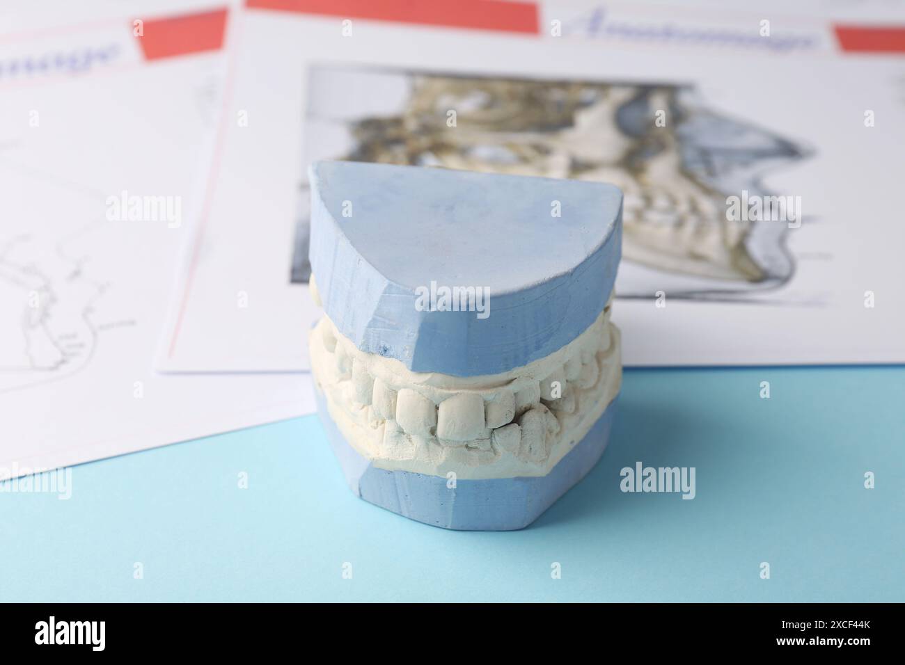 Dental model with gums and anatomy charts on light blue background ...