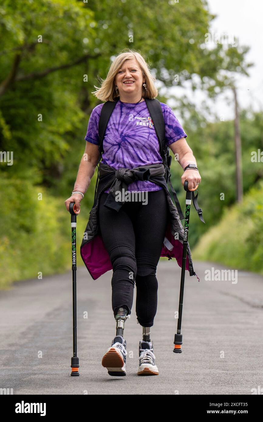 A charity that helps amputees hi-res stock photography and images - Alamy