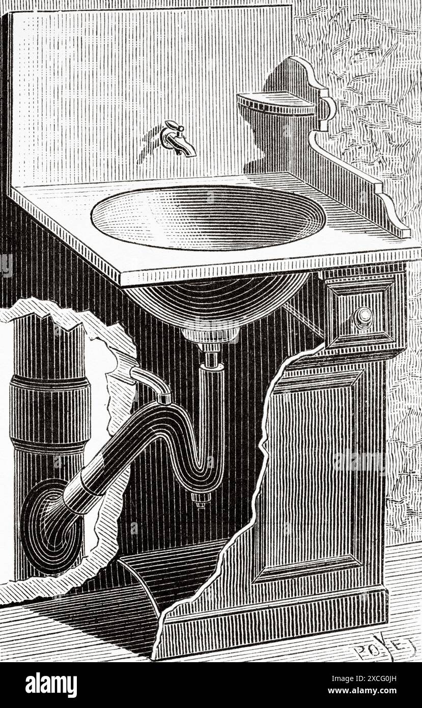 Healthy toilet bowl with water effect and ventilated siphon seal. Old ...