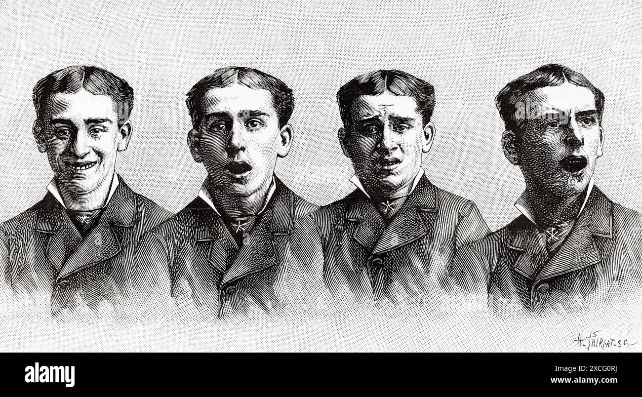 Different expressions of a subject in a cataleptic state. Old 19th ...