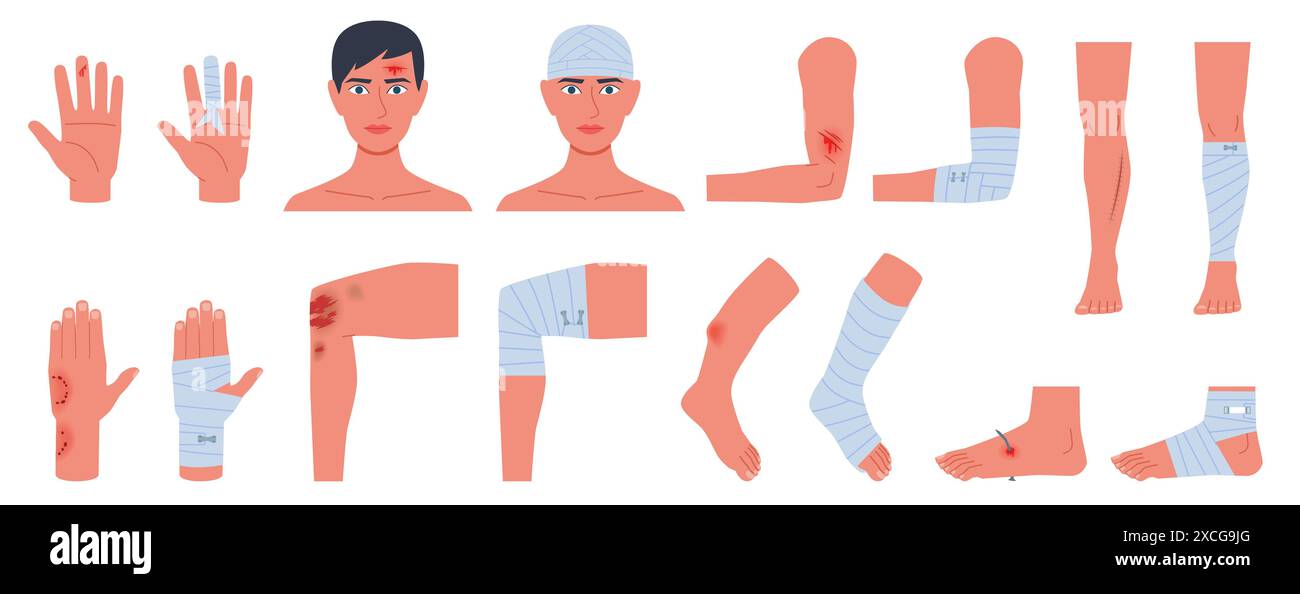 Bandaged body parts. Open wounds, different injuries, abrasions and ...