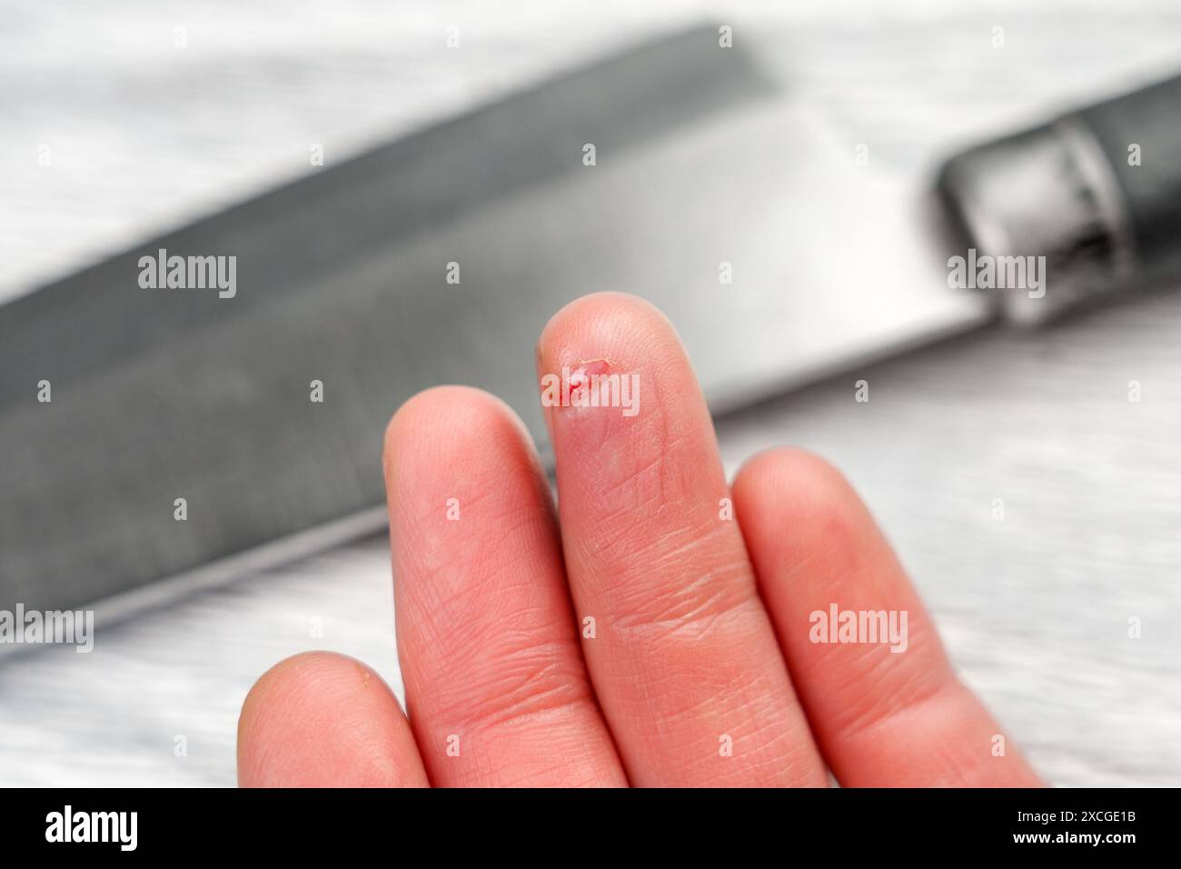 Finger wound with a skin cut and a knife on the table close up ...