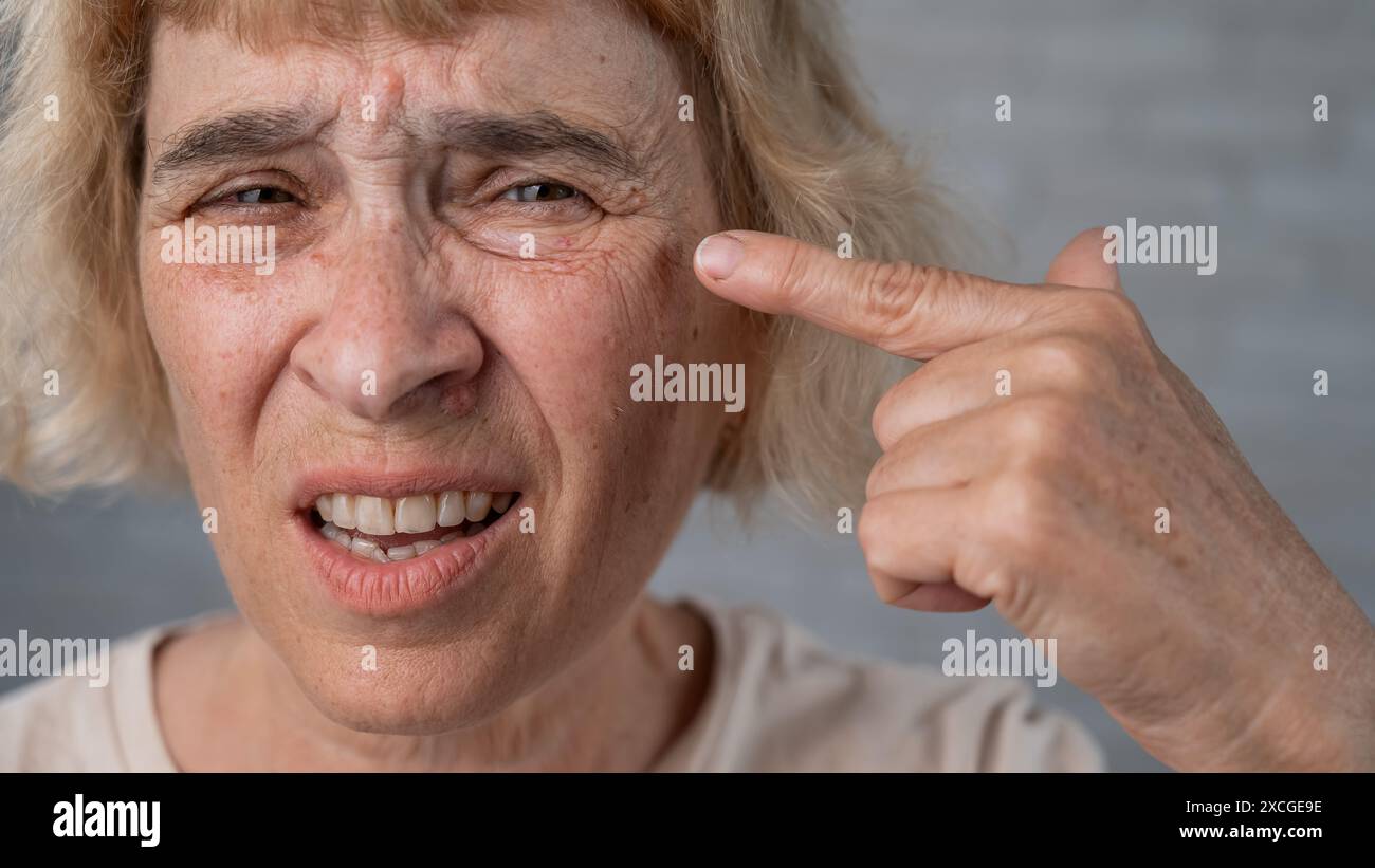 Close-up portrait of an old woman pointing at a wrinkle around her eyes ...