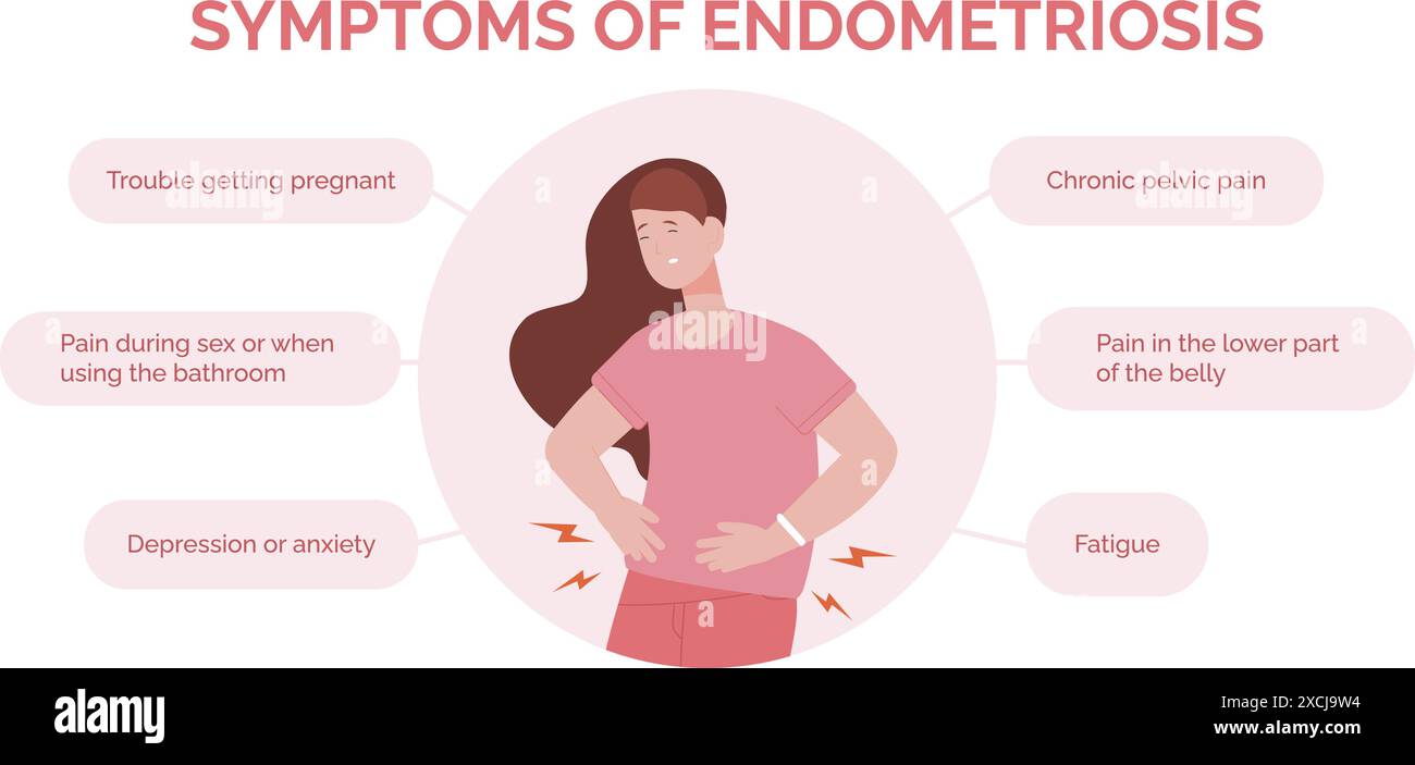 Endometriosis symptoms. Women uterine endometrial disease symptom ...