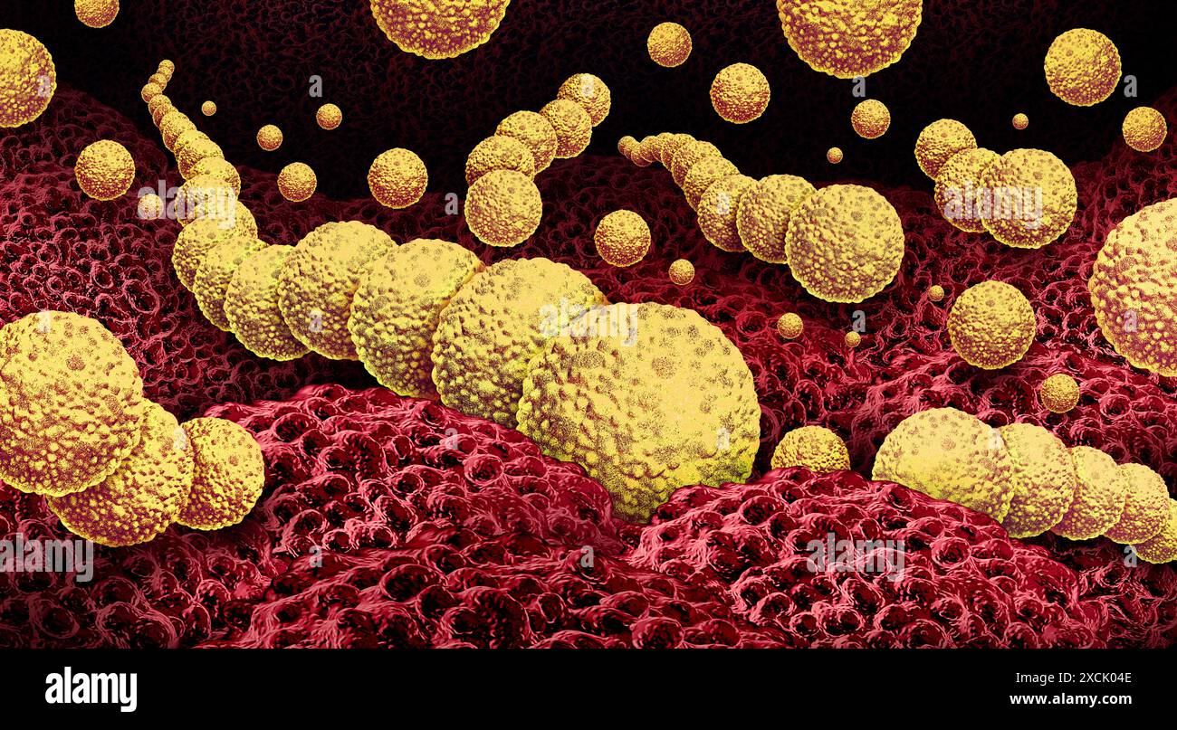 Flesh Eating Bacteria or flesh-eating bactrial infection as a dangerous ... Flesh Eating Bacteria or flesh-eating bactrial infection as a dangerous ...