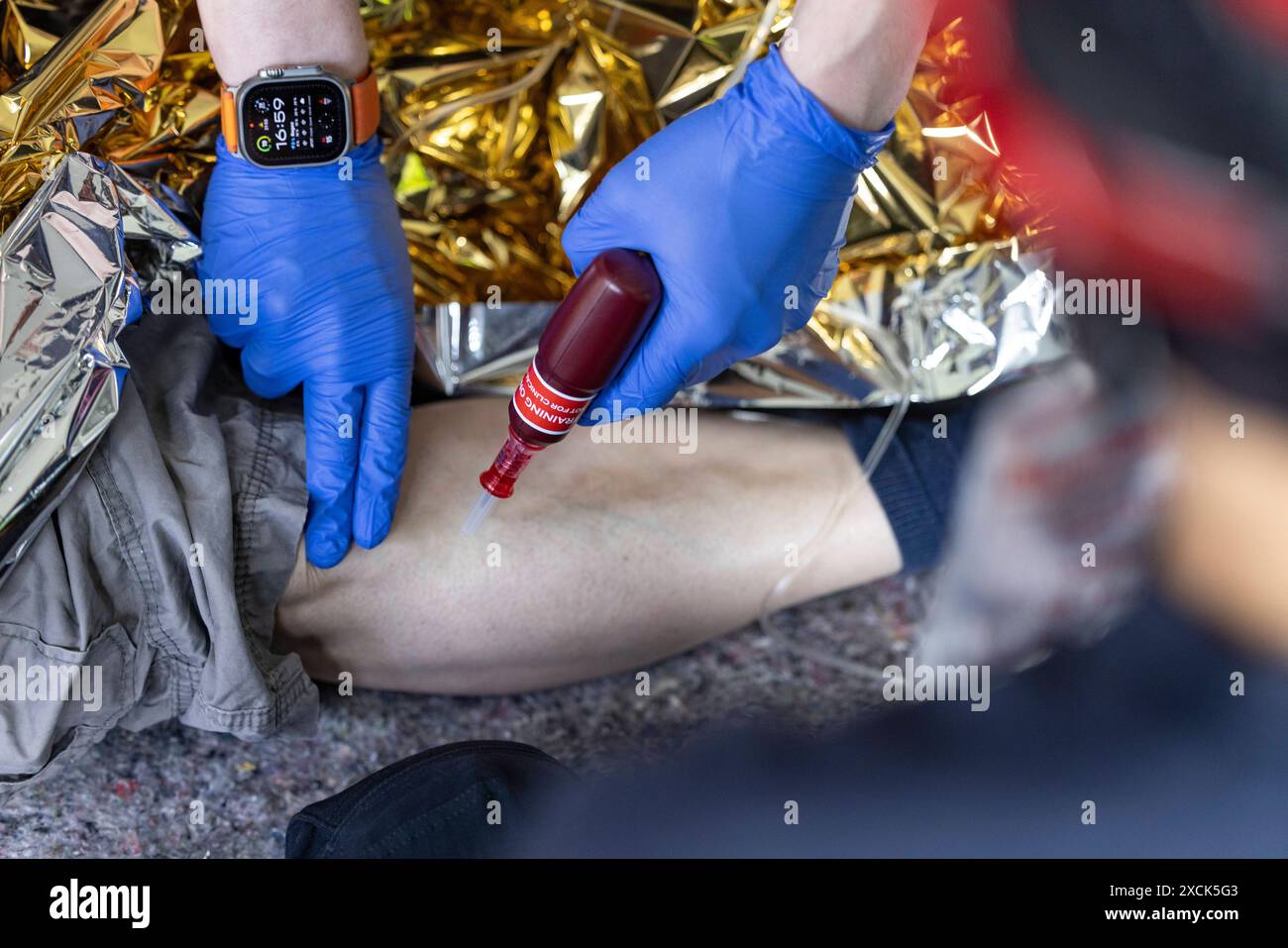 Intraosseous access hi-res stock photography and images - Alamy