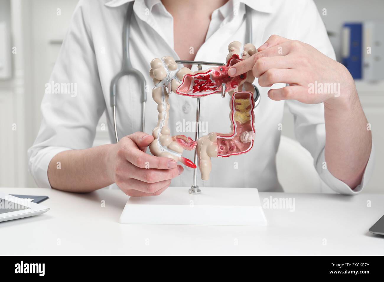 Doctor showing model of large intestine at white table in clinic ...
