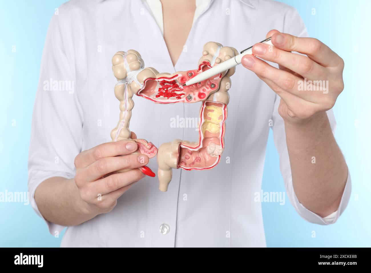 Doctor showing model of large intestine on light blue background ...
