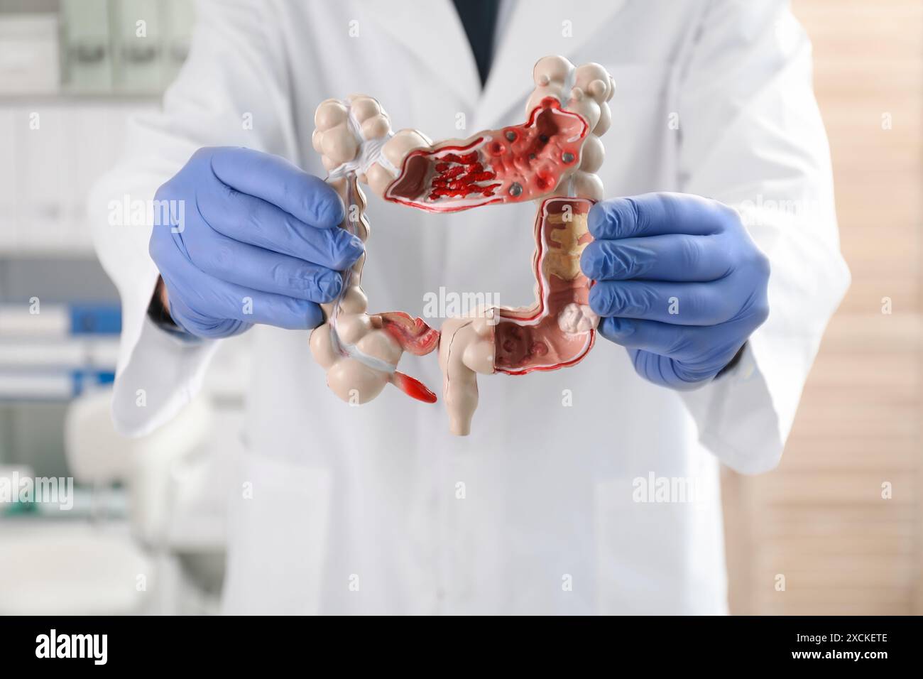 Doctor with model of large intestine in clinic, selective focus Stock ...