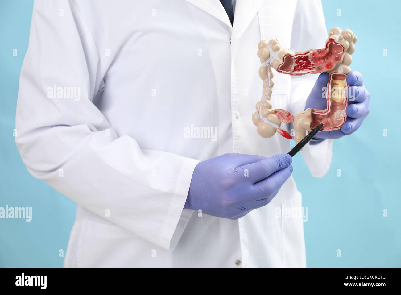 Doctor showing model of large intestine on light blue background ...