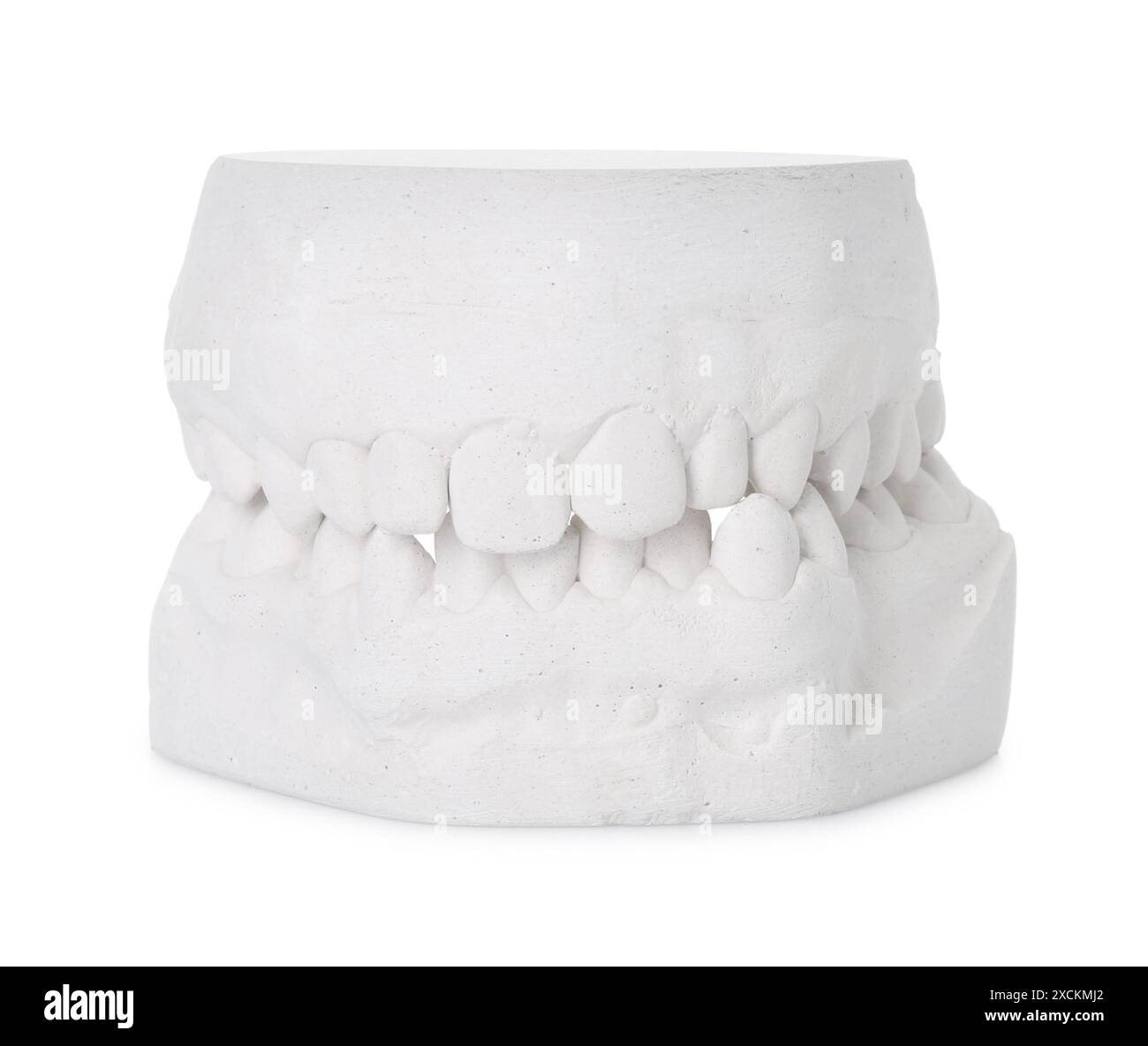 Dental model with gums isolated on white. Cast of teeth Stock Photo - Alamy