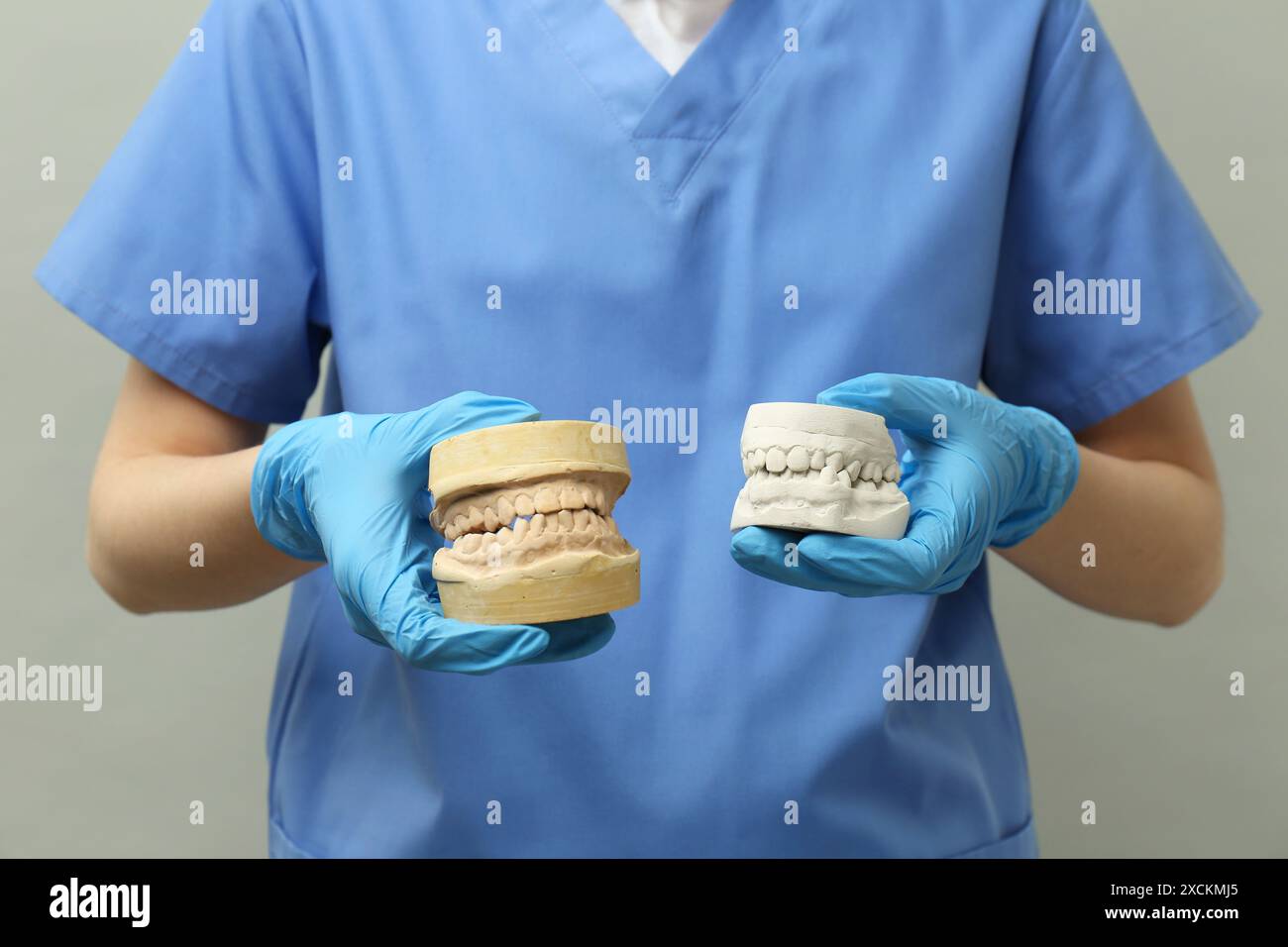 Doctor holding dental models with jaws on grey background, closeup ...