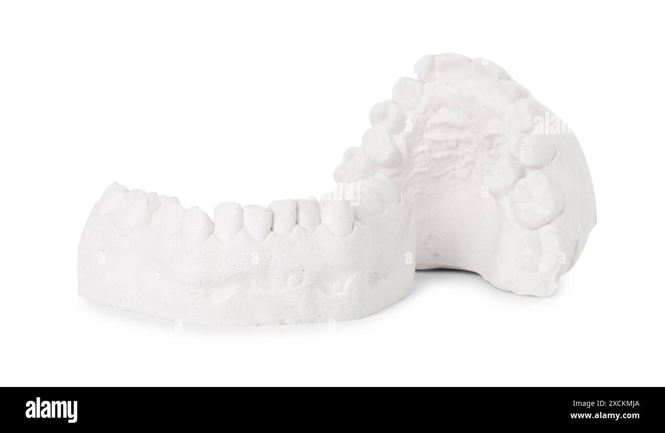 Dental model with gums isolated on white. Cast of teeth Stock Photo - Alamy