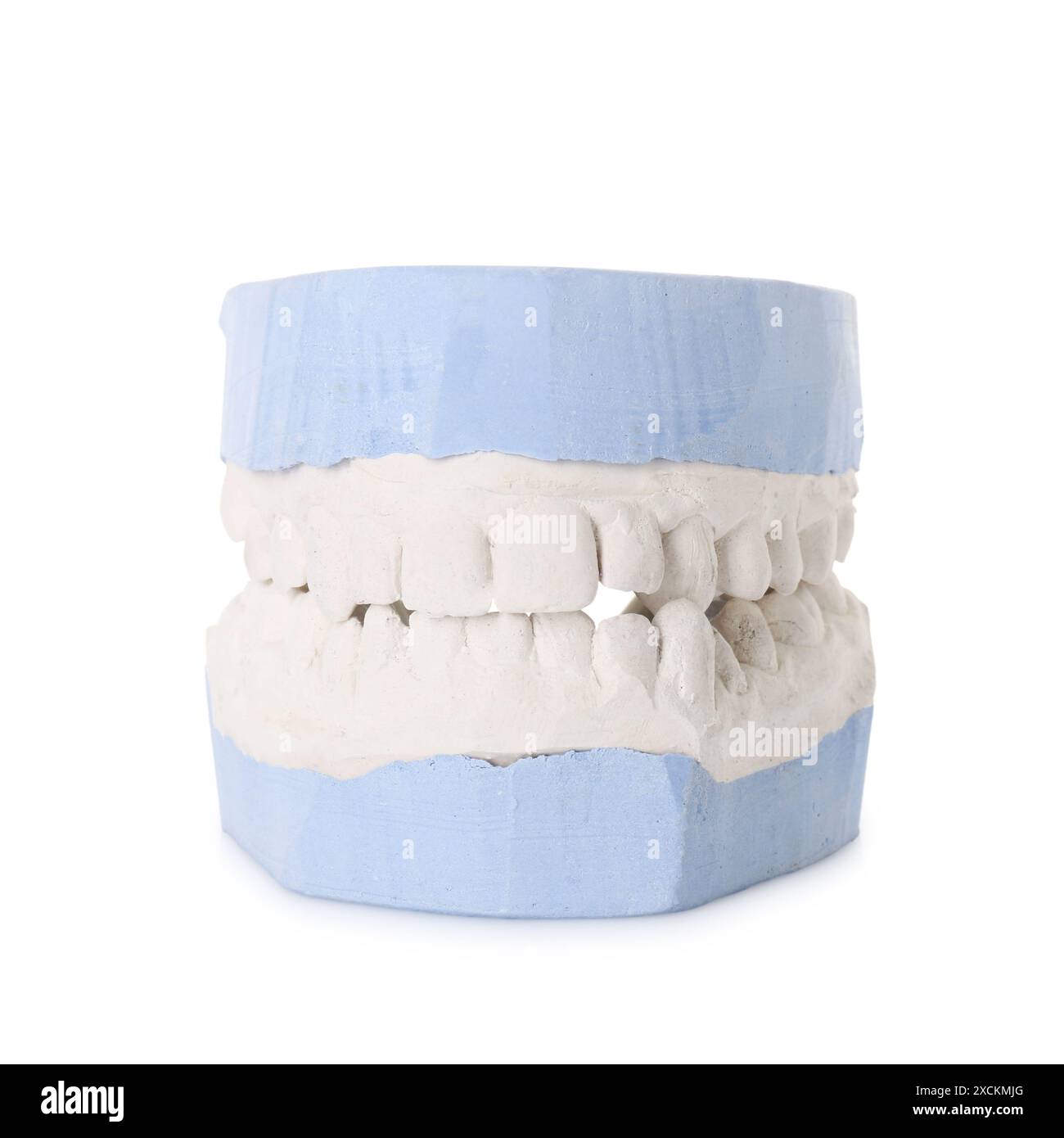 Dental model with gums isolated on white. Cast of teeth Stock Photo - Alamy