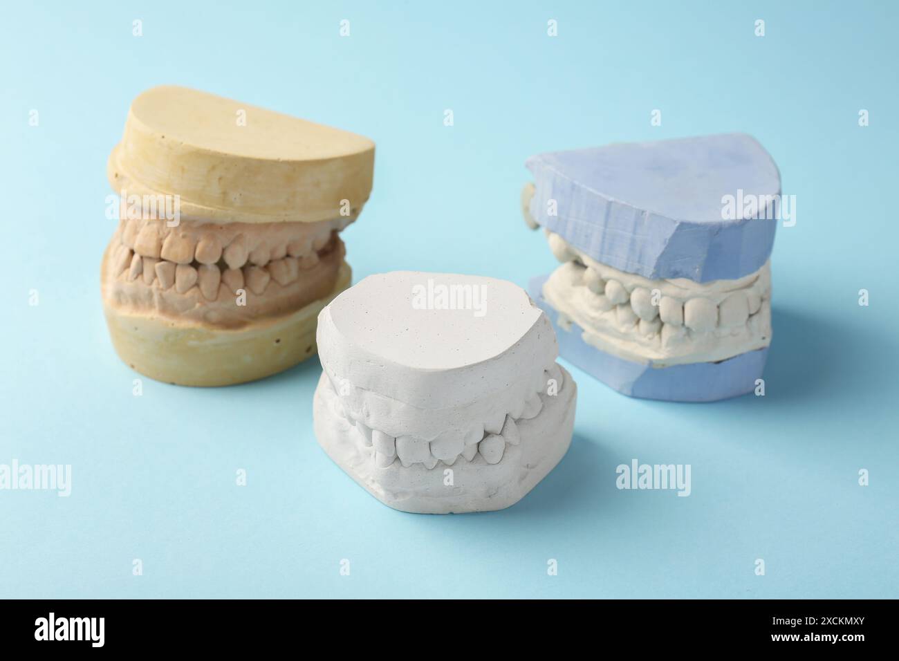Dental models with gums on light blue background. Cast of teeth Stock ...