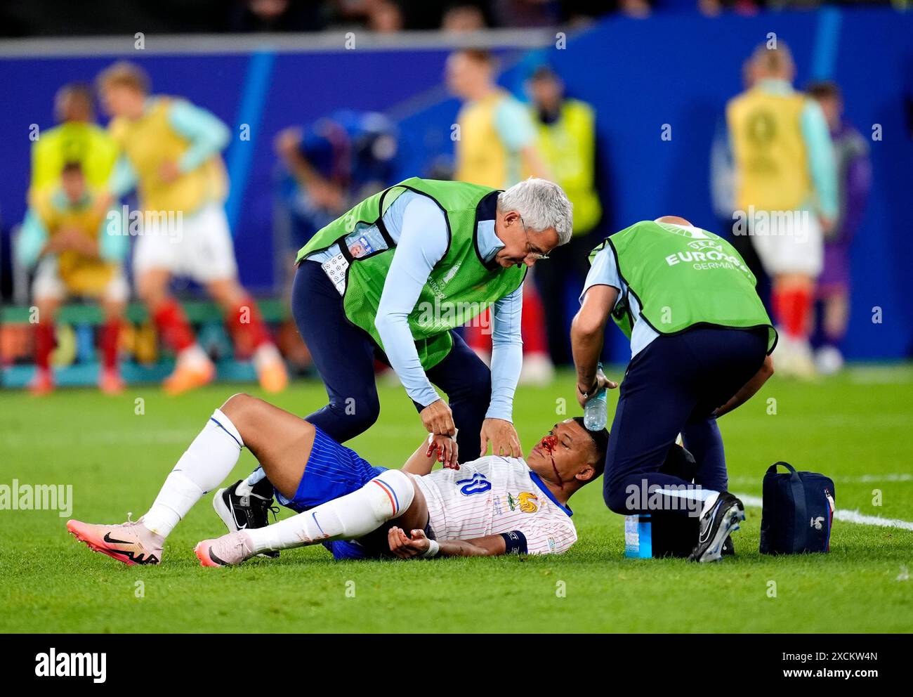 EDITORS NOTE: GRAPHIC France's Kylian Mbappe requires medical attention ...