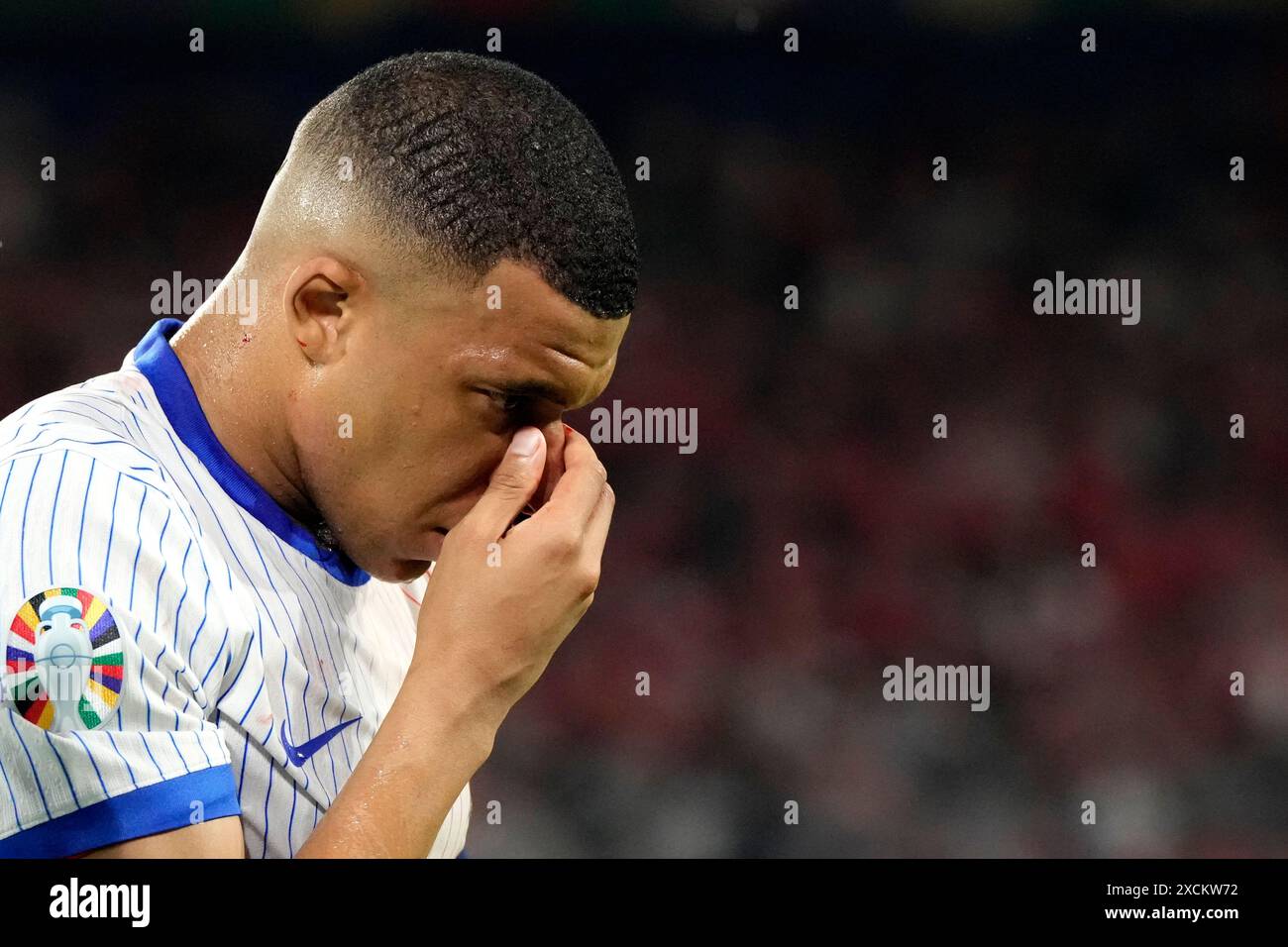 Kylian Mbappe of France holds his nose after suffering an injury during ...