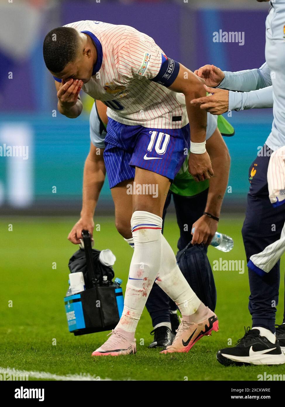 Kylian Mbappe of France holds his nose after suffering an injury during ...
