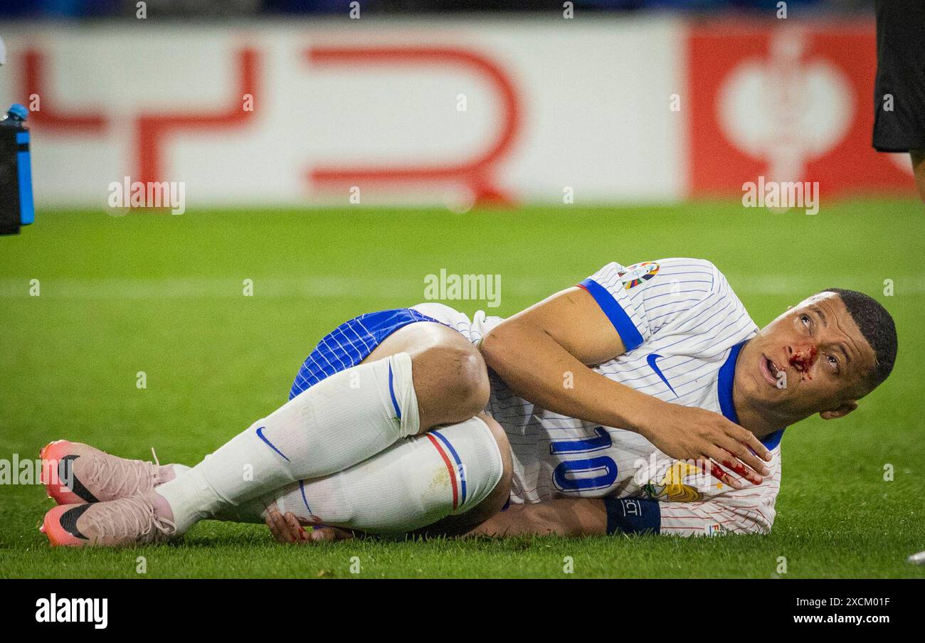 Kylian mbappe nose austria france 2024 hi-res stock photography and ...