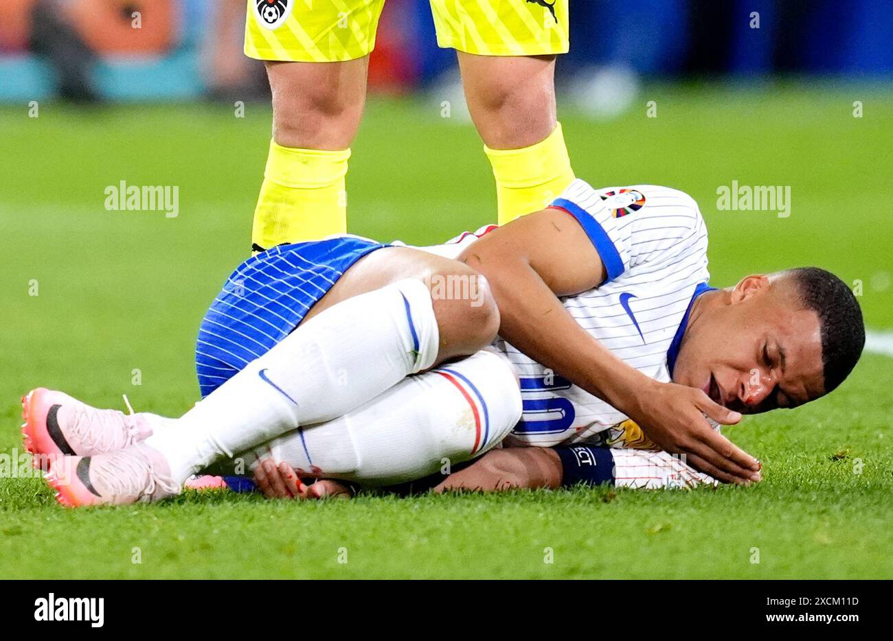 France's Kylian Mbappe lies injured on the pitch after colliding with ...