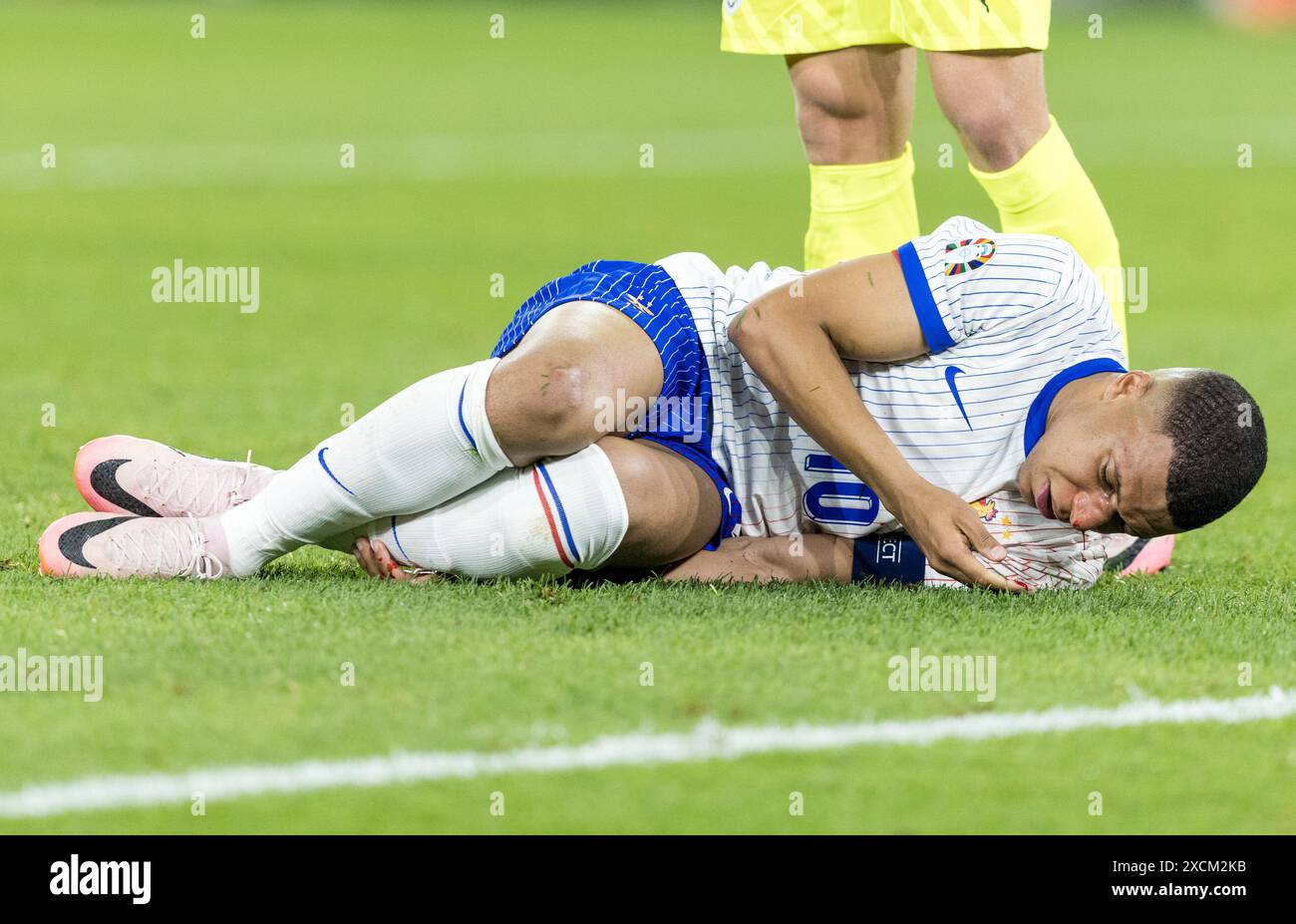 Football injury blood hi-res stock photography and images - Alamy