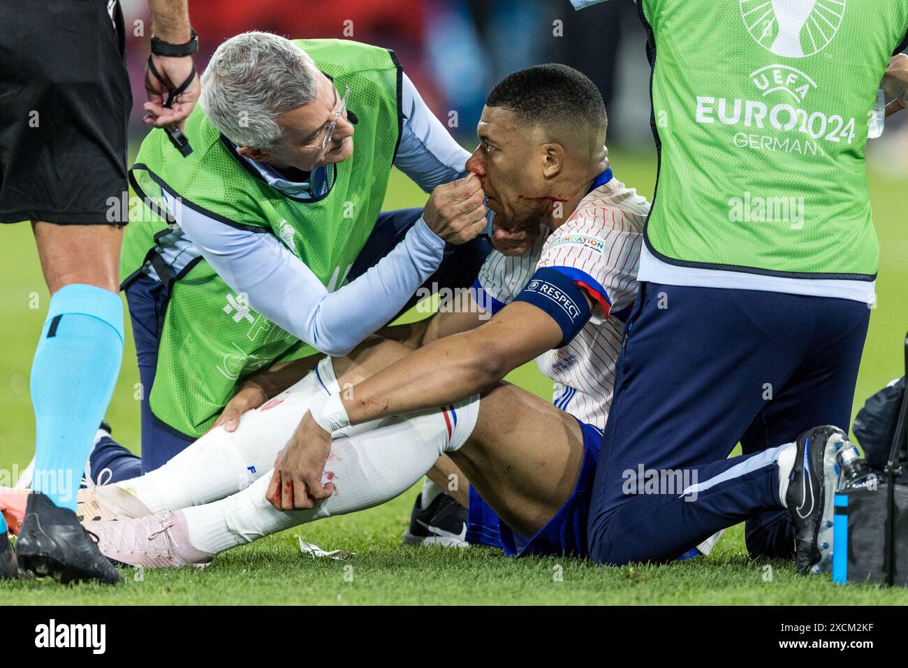 Injury blood football hi-res stock photography and images - Alamy