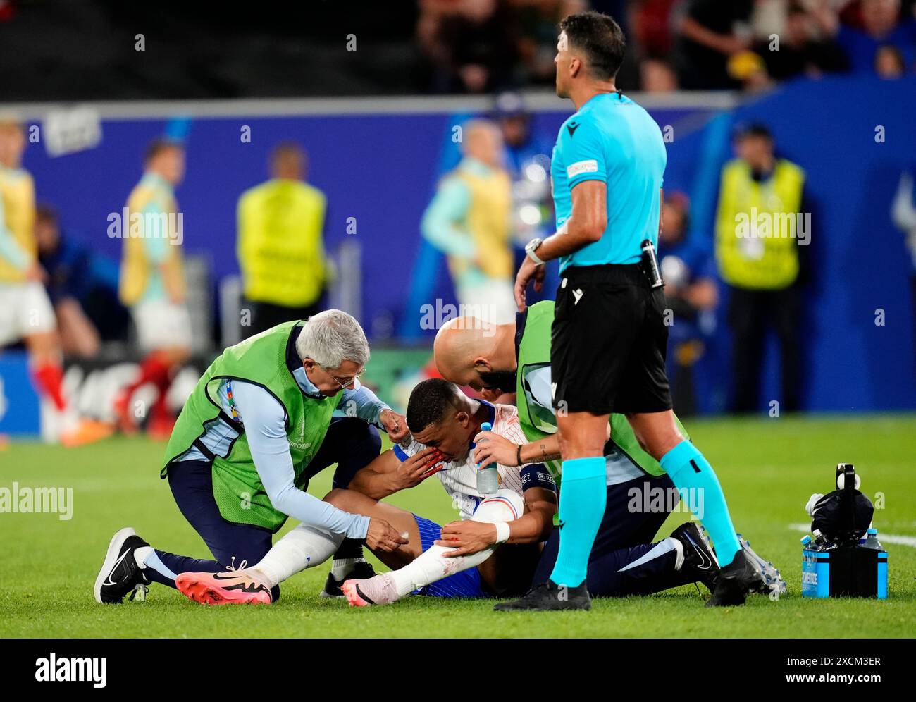 EDITORS NOTE: GRAPHIC France's Kylian Mbappe requires medical attention ...