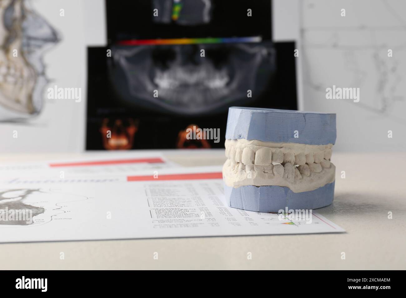 Dental model with gums, anatomy charts and panoramic x-ray on table ...