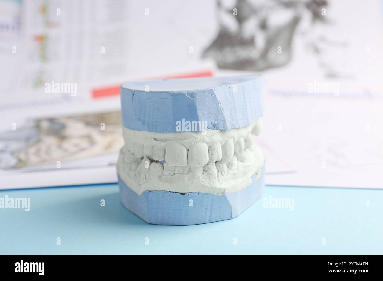 Dental model with gums and anatomy charts on light blue background ...