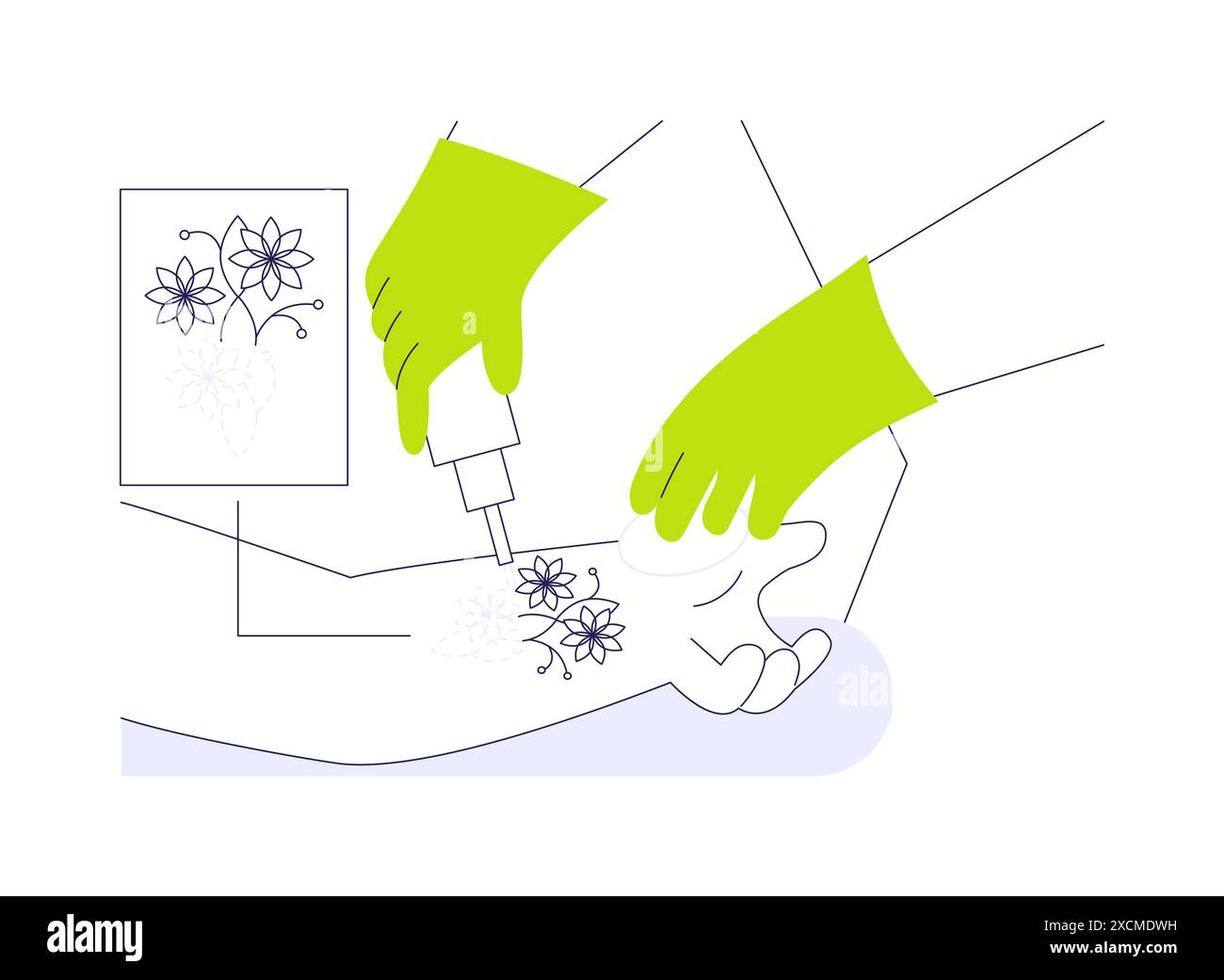 Tattoo removal abstract concept vector illustration Stock Vector Image ...