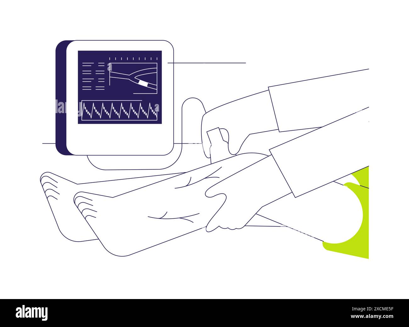 Doppler ultrasound abstract concept vector illustration Stock Vector ...