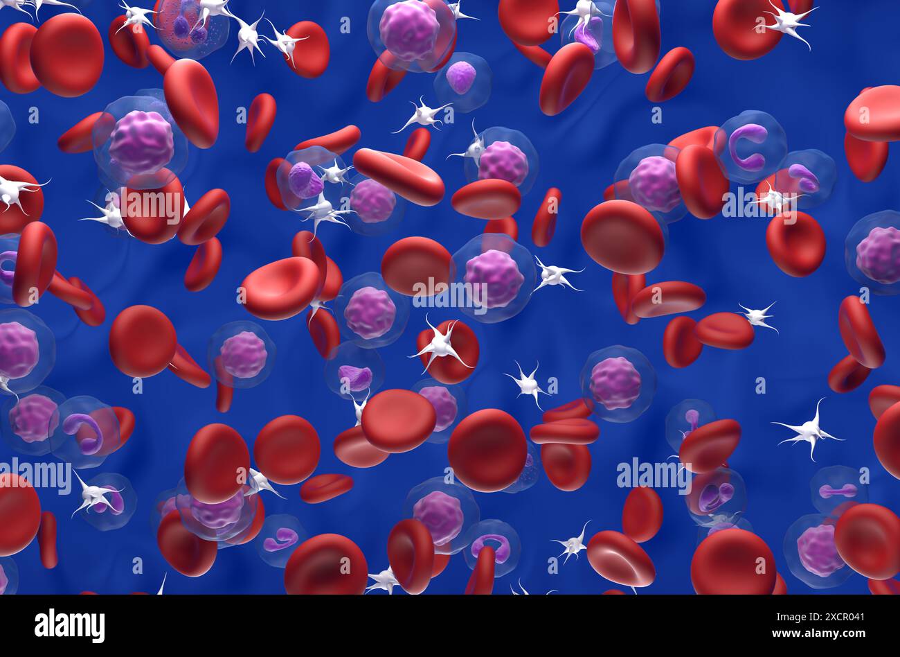 High level of RBC and platelet in Polycythemia vera (PV) - isometric ...
